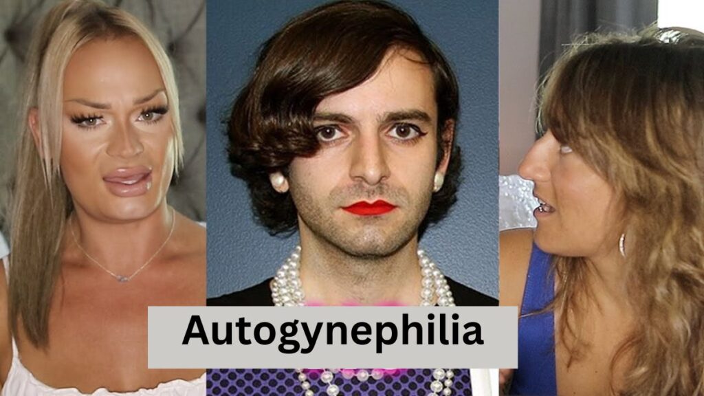 Unlocking Autogynephilia - Gender Dysphoria: Understanding, Acceptance ...