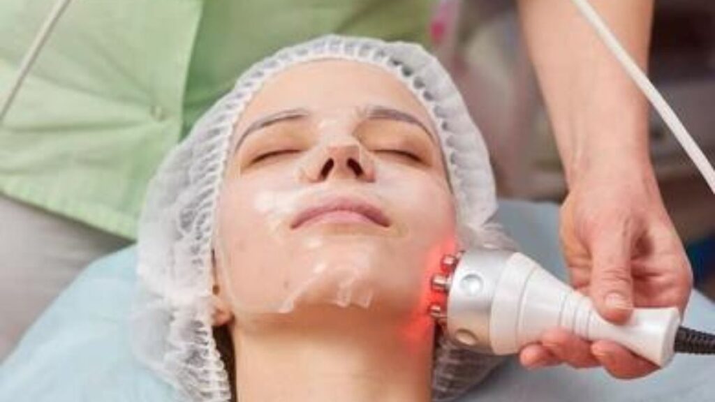 Benefits of RF Skin Tightening for Youthful-Looking Skin